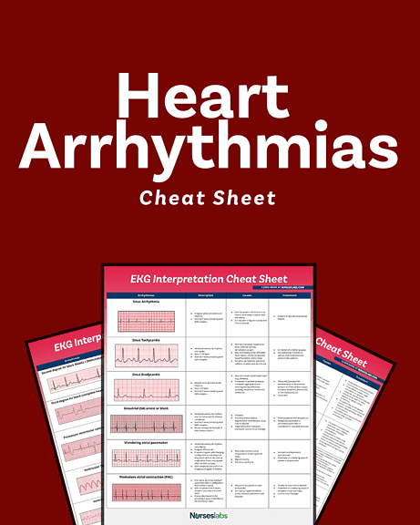 EKG Interpretation Cheat Sheet & Heart Arrhythmias Guide (2020 Update)