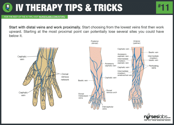 Anesthesia Experts | 55 IV Therapy Tips and Tricks: How to Hit the Vein ... Anesthesia Experts | 55 IV Therapy Tips and Tricks: How to Hit the Vein ...