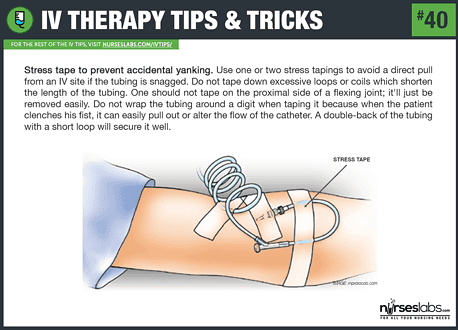 55 IV Therapy Tips and Tricks: How to Hit the Vein in One Shot ...