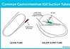 Nasogastric Intubation: Insertion Procedures & Technique