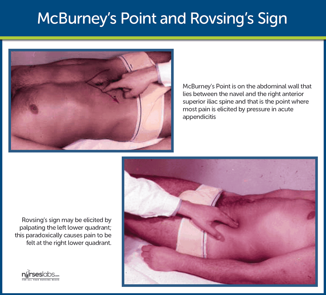 Appendicitis Nursing Care Management Study Guide