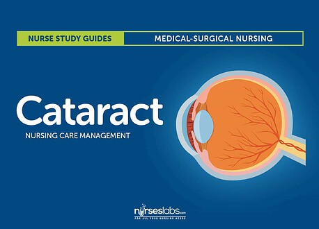 Cataract Nursing Care Management: Study Guide for Nurses