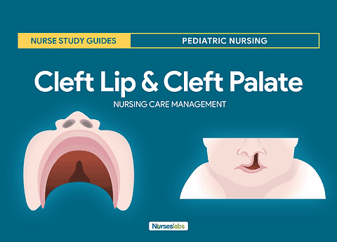 Cleft Lip and Cleft Palate Nursing Care Management