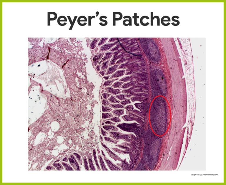 Lymphatic System Anatomy and Physiology - Nurseslabs