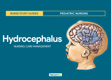 Hydrocephalus Nursing Care Planning and Management: Study Guide