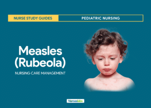 Measles (Rubeola) Nursing Care Planning and Management - Study Guide