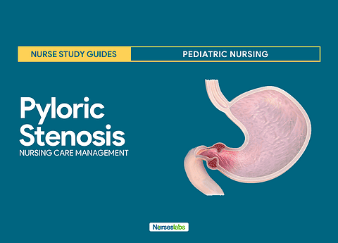Pyloric Stenosis Nursing Care Planning and Management