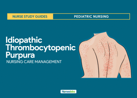 Idiopathic Thrombocytopenic Purpura Nursing Care Management - Nurseslabs