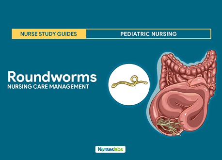 Roundworms (Ascariasis) - Nurseslabs