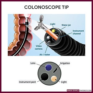 Colonoscopy - Nursing Responsibilities and Procedures - Nurseslabs