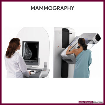Mammography (Mammogram) - Nursing Responsibilities - Nurseslabs
