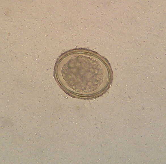 Roundworms (Ascariasis) - Nurseslabs