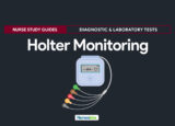 Holter Monitoring - Nursing Responsibilities and Care Plan - Nurseslabs