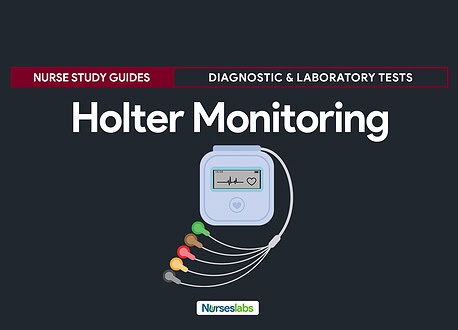 Holter Monitoring - Nursing Responsibilities and Care Plan - Nurseslabs