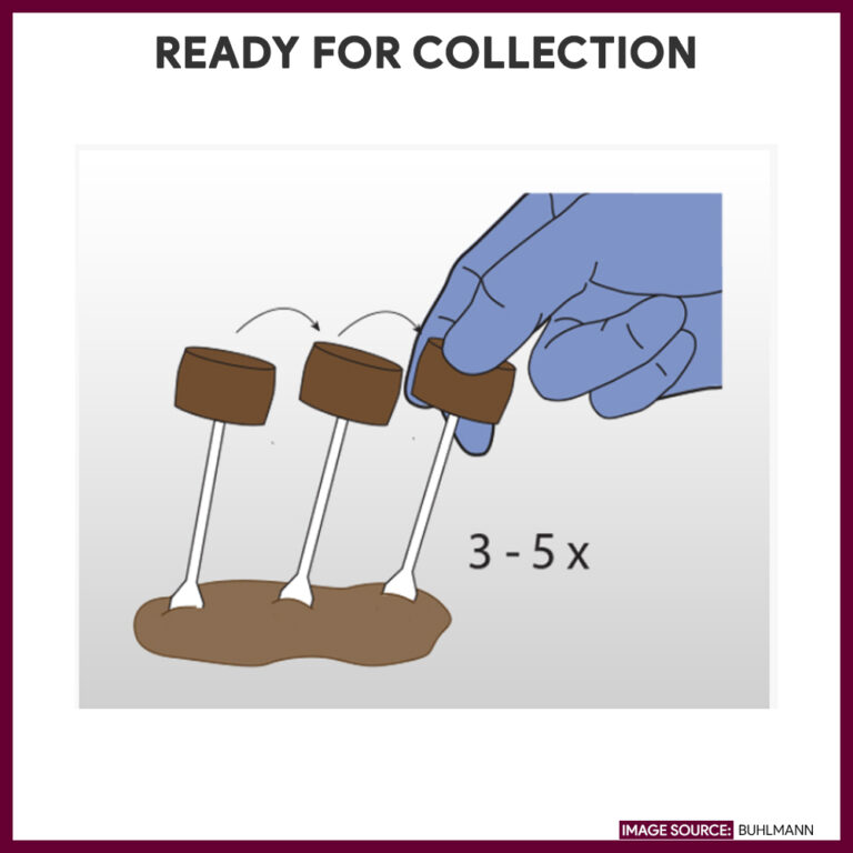Fecal Analysis (Stool Analysis) Nursing Responsibilities - Nurseslabs