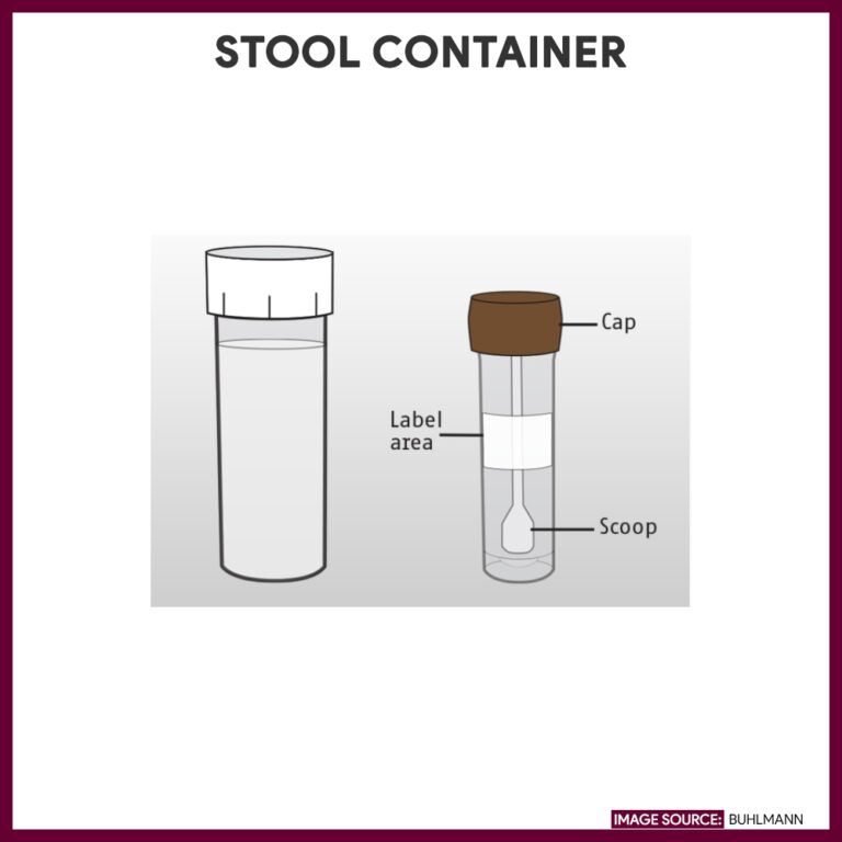 Fecal Analysis (Stool Analysis) Nursing Responsibilities - Nurseslabs
