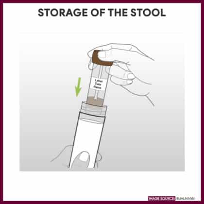 Fecal Analysis (Stool Analysis) Nursing Responsibilities - Nurseslabs