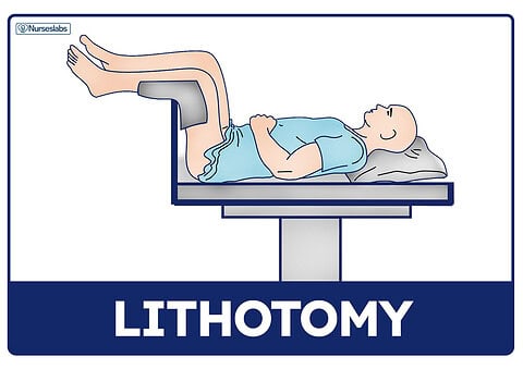 Patient Positioning Cheat Sheet & Complete Guide for 2023